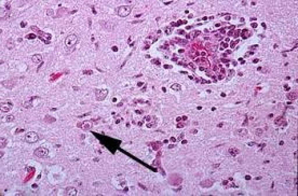 How to Treat Distemper in Dogs? Hidden Facts Revealed!